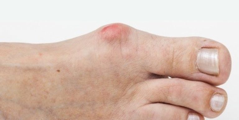 Toe Deformities – 4 Life Podiatry