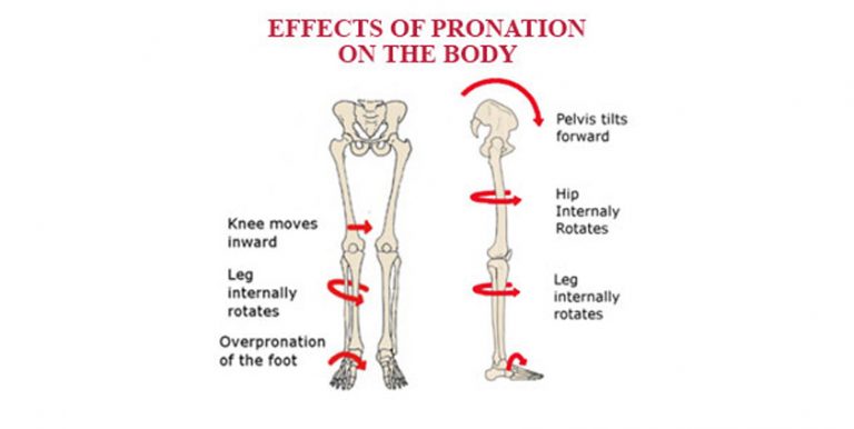 Over Pronation – 4 Life Podiatry
